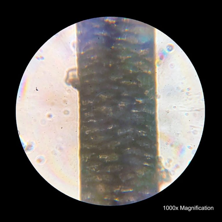 Hair Under Microscope: Structure, Analysis, and Health Insight