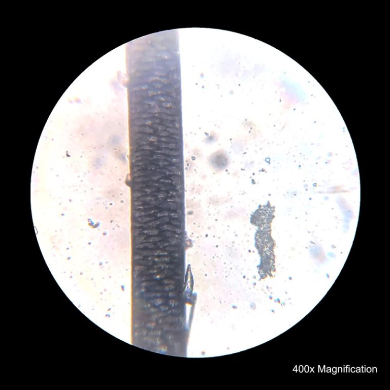 Hair Under Microscope: Structure, Analysis, and Health Insight