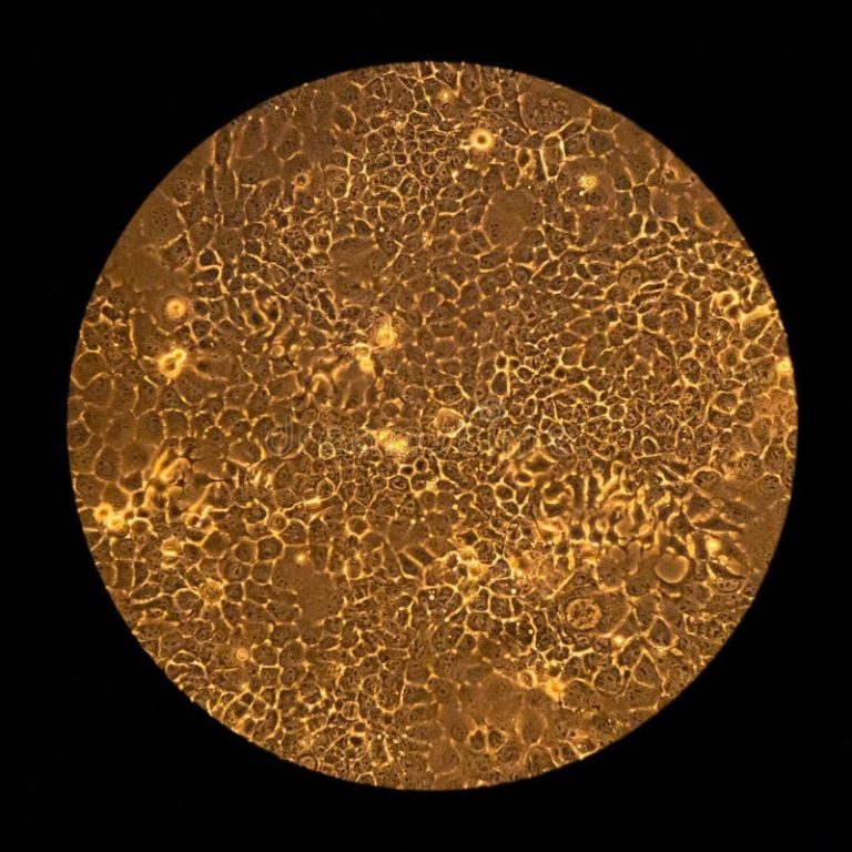 Yeast Under Microscope: Structure, Types, and Techniques