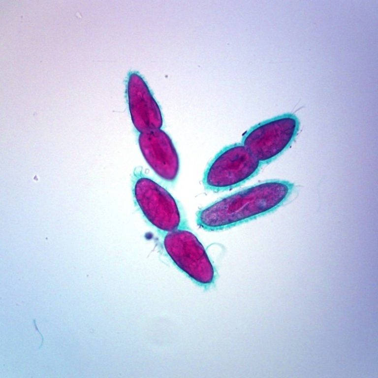 Paramecium Under Microscope: A Complete Guide for Students