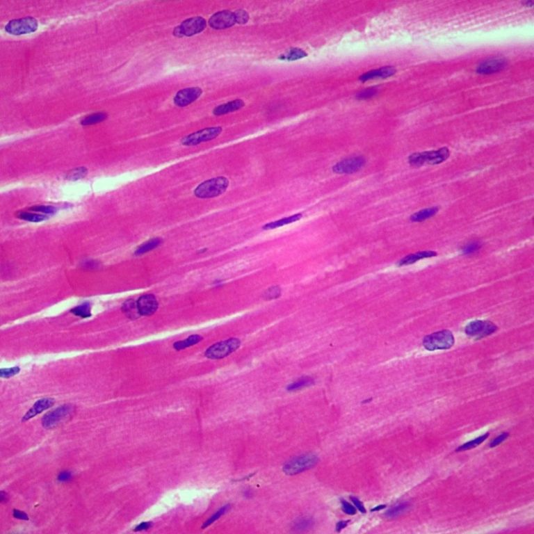Cardiac Muscle Under Microscope: A Closer Look at Histology