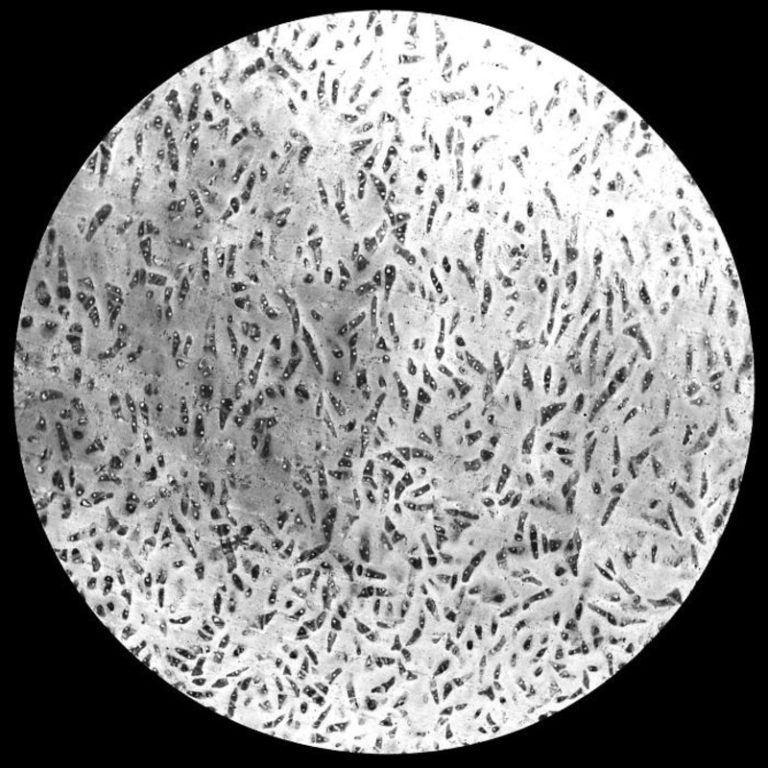 Hyaline Cartilage Under Microscope: Structure and Functions