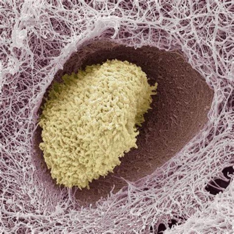 Hyaline Cartilage Under Microscope: Structure and Functions